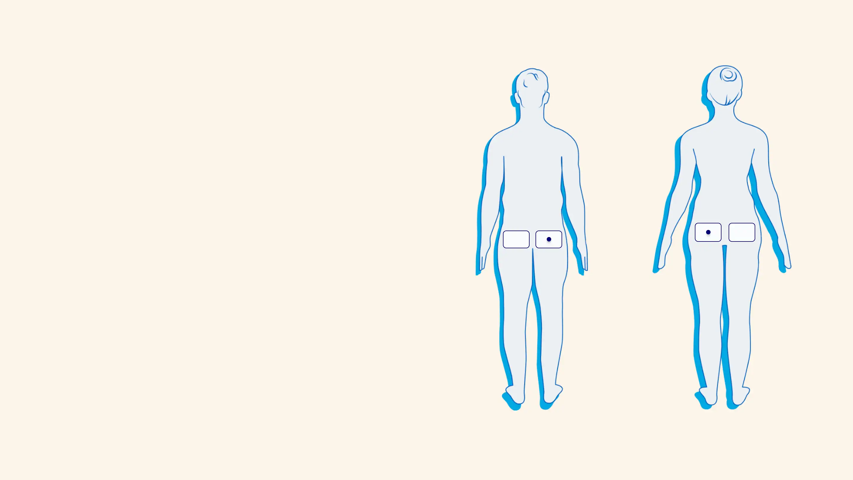 CoolTone®: Benefits, Results & Treatment Guide | Allē