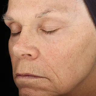 SkinMedica®: Benefits, Results & Treatment Guide | Allē