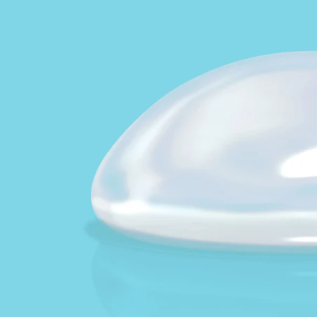 Natrelle®: Benefits, Results & Treatment Guide | Allē