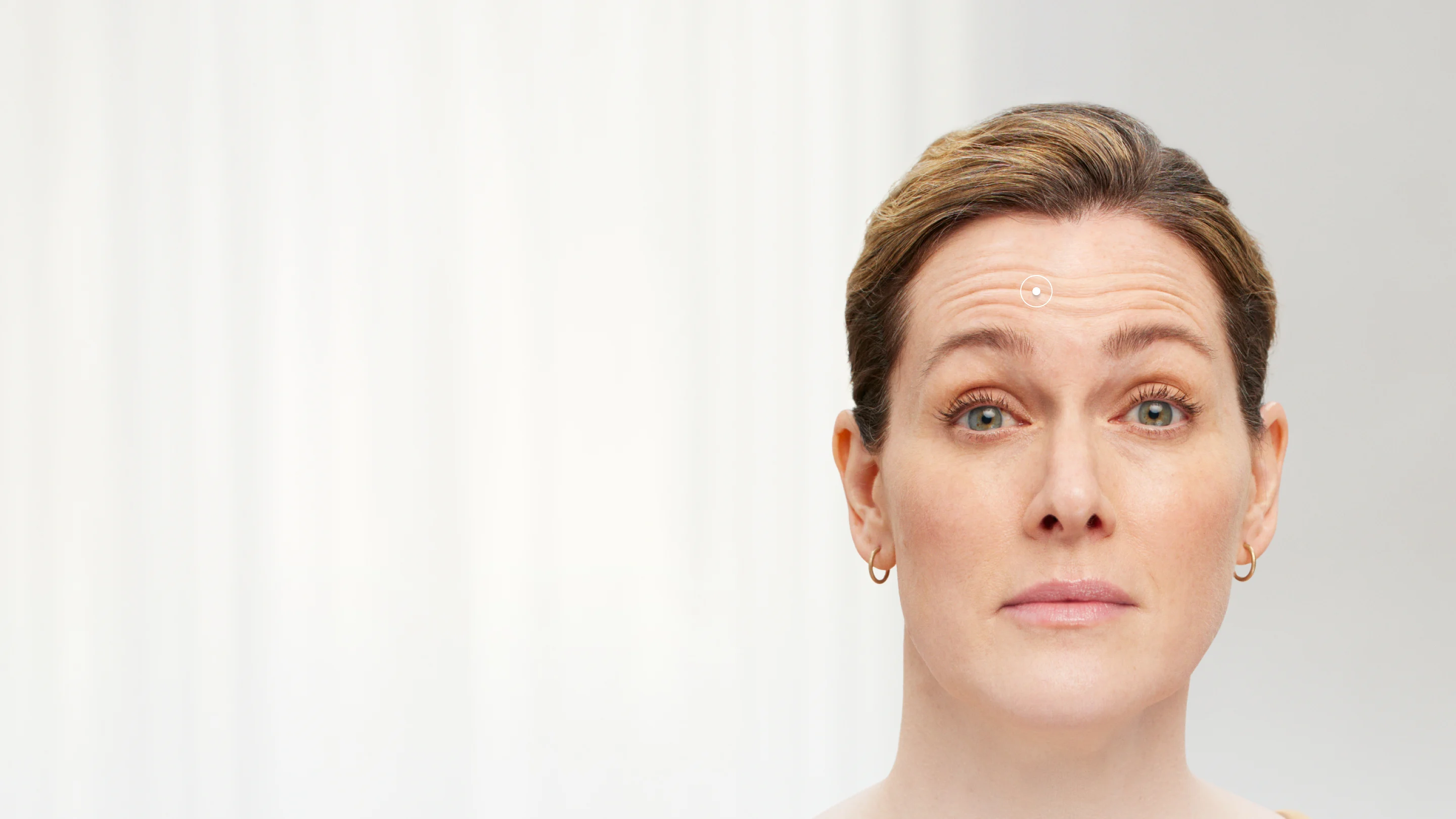 BOTOX®: Benefits, Results & Treatment Guide | Allē